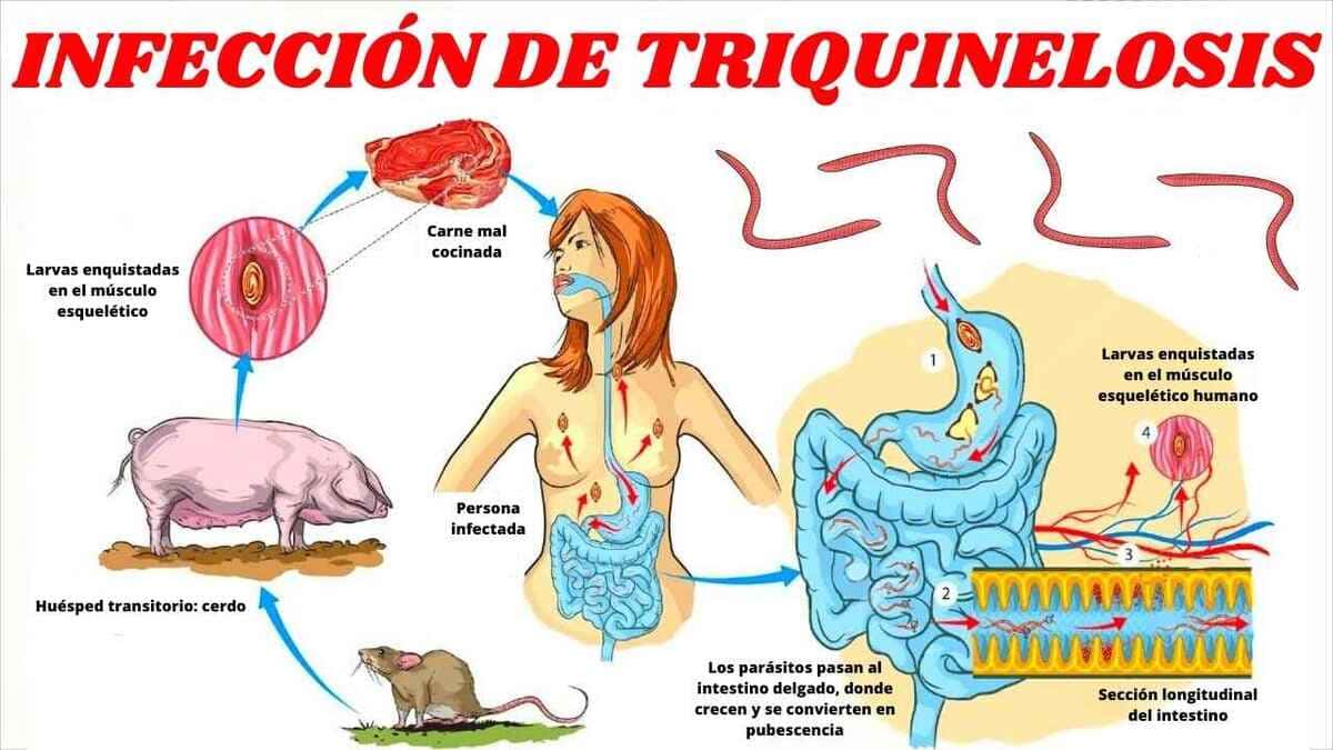 Esta infografía detalla cómo se transmite al ser humano la ...